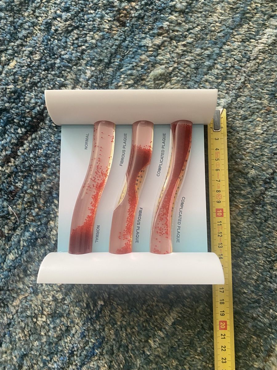 Anatomie Modell, Arterien mit Plaque, sehr anschaulich! (Neu (gemäss ...