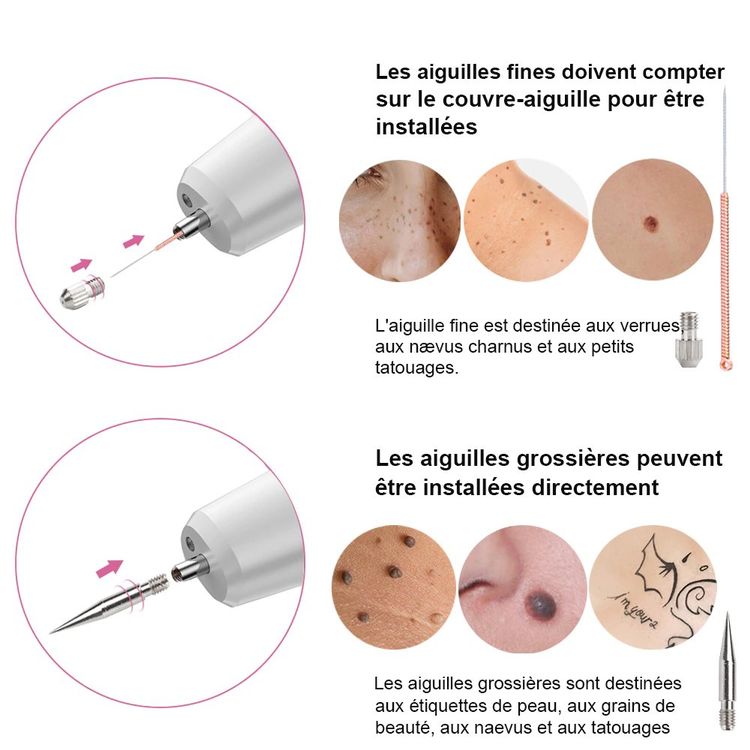 Appareil plasma laser élimine verrues tache cutané rousseur (Neu und ...