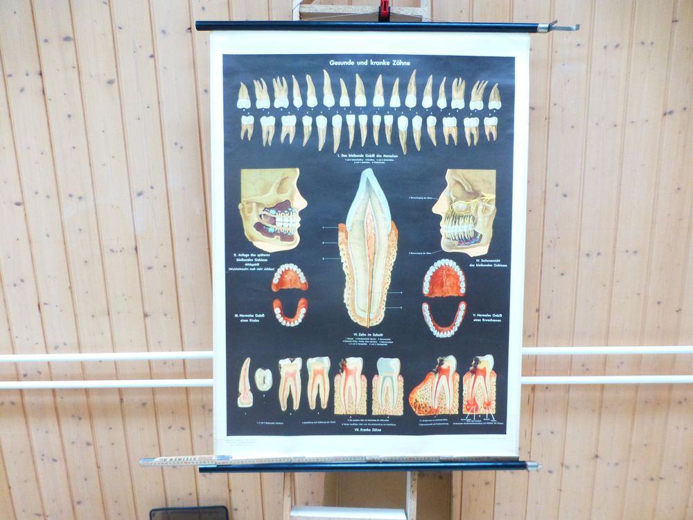 Unterrichtswerk , Wandkarte Zähne (gesunde und kranke) | Kaufen auf Ricardo