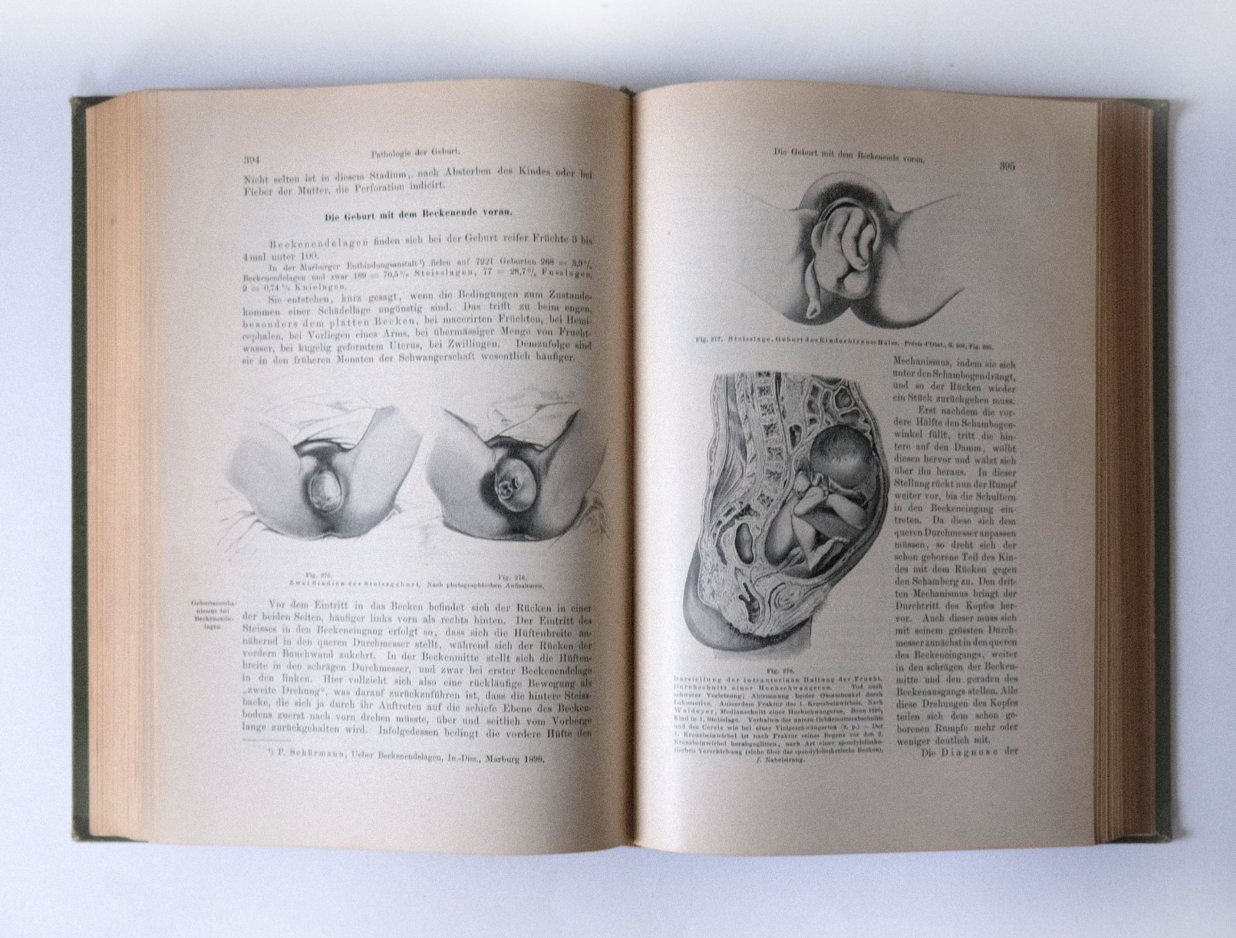 Lehrbuch der Geburtshilfe. F. Ahlfeld. 1898. Verl. Grunow. (Gebraucht ...