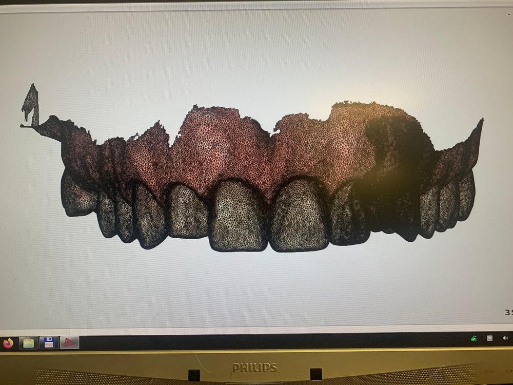 Straumann Dental Wings 3 Series 3D Scanner (Gebraucht) in Hölstein für ...