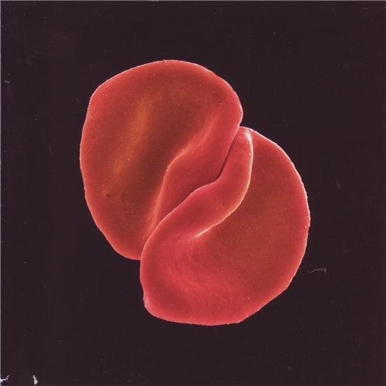 Peter Gabriel - Scratch My Back (Special Edition, 2 CDs) (Gebraucht) in ...