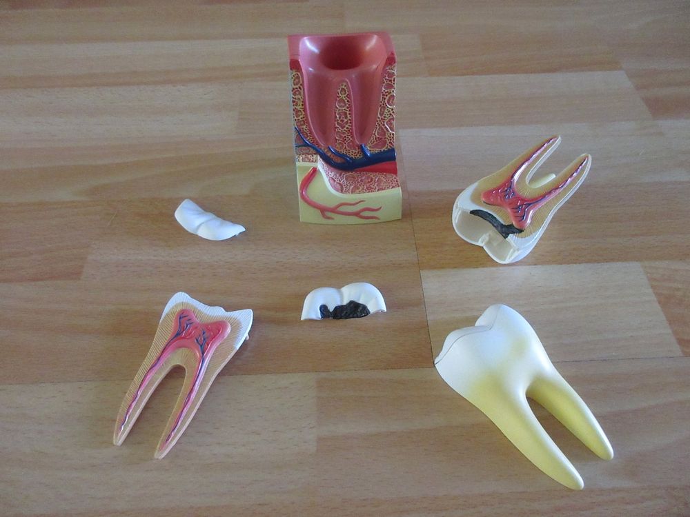 4D Puzzle Backenzahn Molar Modell (Gebraucht) in Kaisten für CHF 21 ...