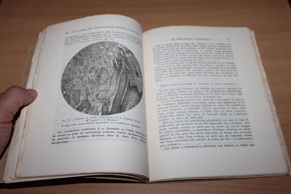 Le Problème Biologique du Cancer - Jacques Delarue (Gebraucht) in Kaden ...