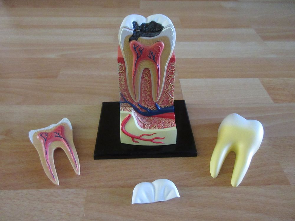 4D Puzzle Backenzahn Molar Modell (Gebraucht) in Kaisten für CHF 21 ...