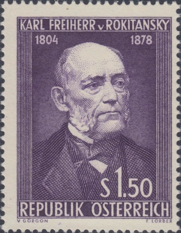 Österreich 997 150.Geburtstag von Freiherr v. Rokitansky ** (Neu (gemäss Beschreibung)) in ...