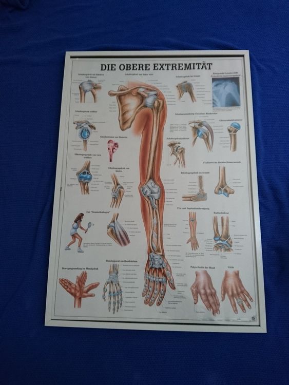Obere Extremität des Menschen auf Grossposter (Gebraucht) in Basel für ...