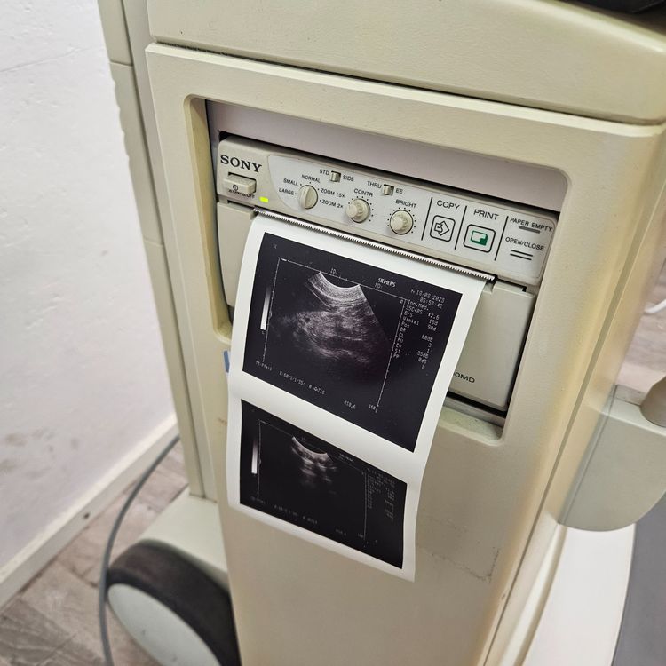 SIEMENS SONOLINE Prima - Ultraschall Diagnostik (Gebraucht) in ...