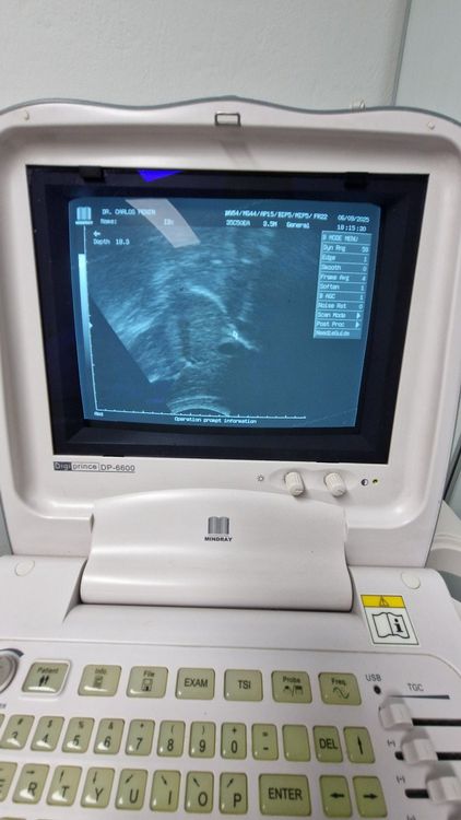 Echographe Mindray DP-6600, Trolley UMT-100 et imprimante (Gebraucht ...