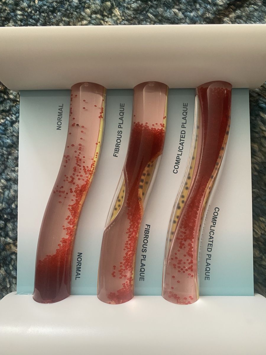 Anatomie Modell, Arterien mit Plaque, sehr anschaulich! (Neu (gemäss ...