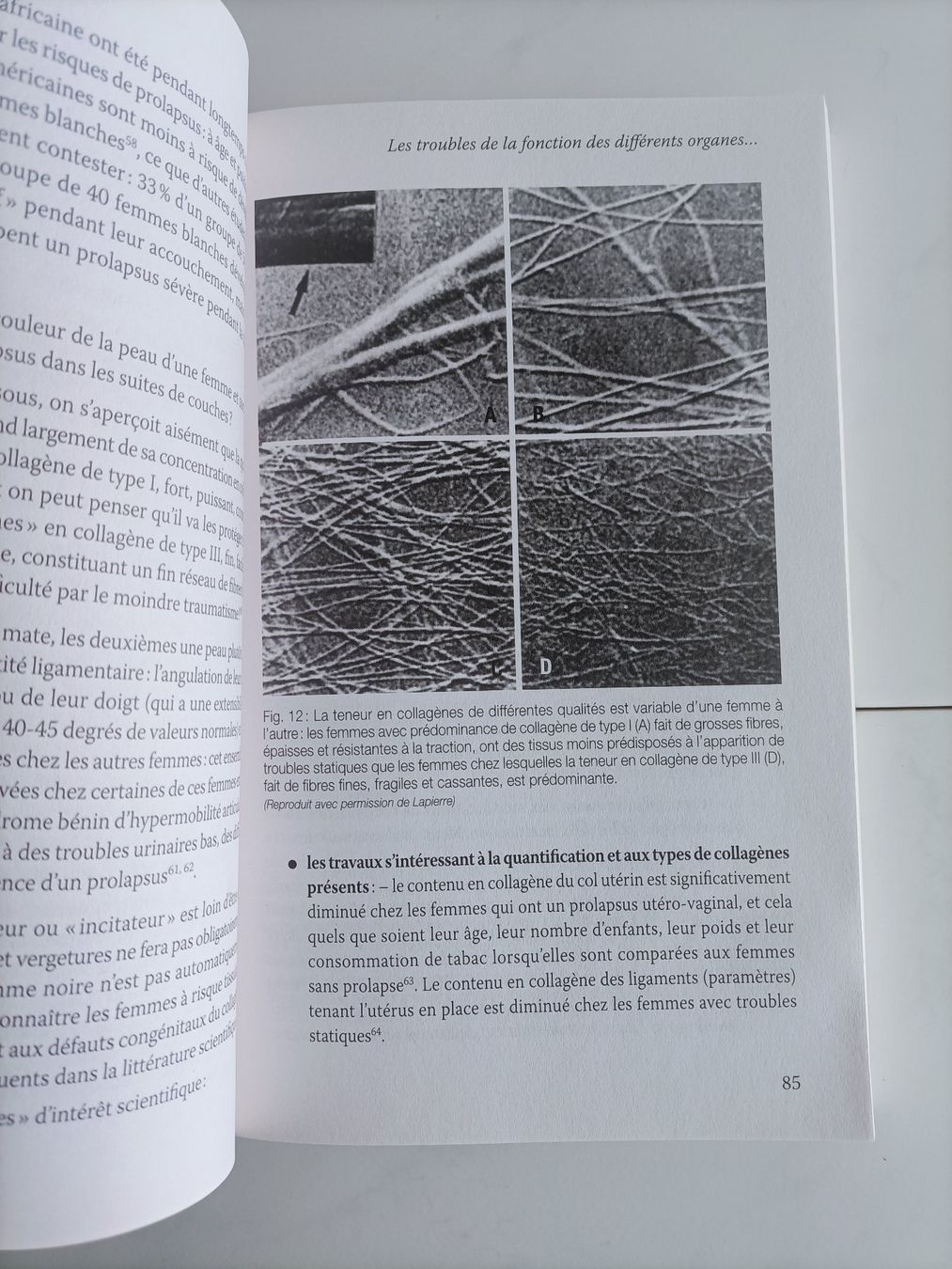 Le plancher pelvien - Osons en parler ! - Connaître son inti (D ...