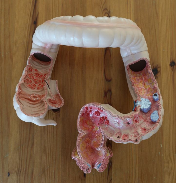 3B Anatomie Modell Dickdarm Enddarm (Gebraucht) in Luzern für CHF 69 ...