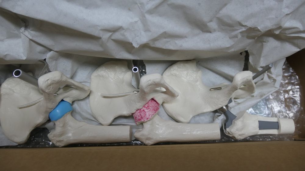 Hüfte-Vorzeigemodell: Arthrose-Prothese (Neu und originalverpackt) in ...