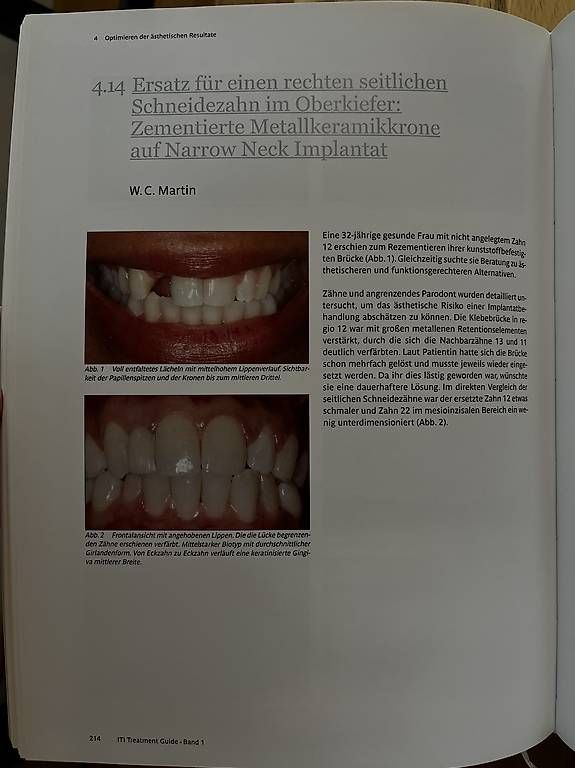 ITI Treatment Guide Band 1 Deutsch Ästhetische Therapie (Gebraucht) in ...