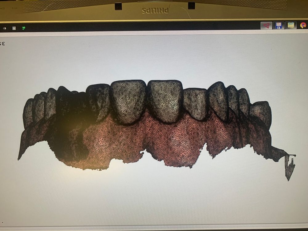 Straumann Dental Wings 7 Series 3D Scanner (Gebraucht) in Hölstein für ...